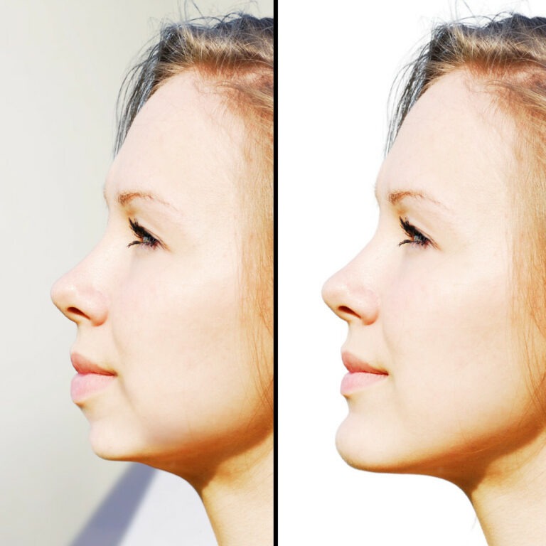 Les types de nez - Chirurgie-avant-apres.fr