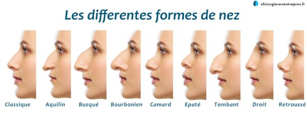 Quelles sont les 9 formes de nez ? - Chirurgie-avant-apres.fr