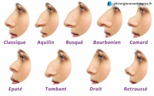 Les types de nez - Chirurgie-avant-apres.fr