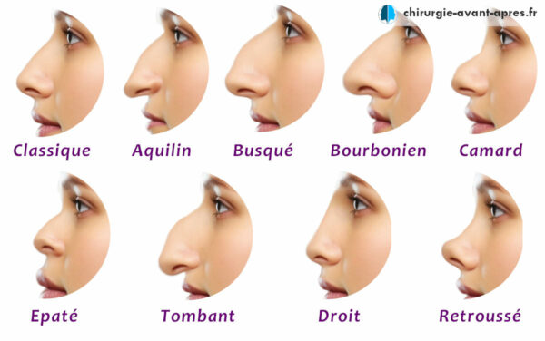 Les types de nez - Chirurgie-avant-apres.fr