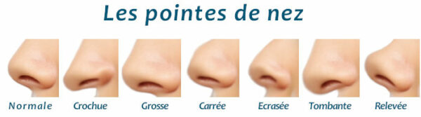 Rhinoplastie de la pointe du nez
