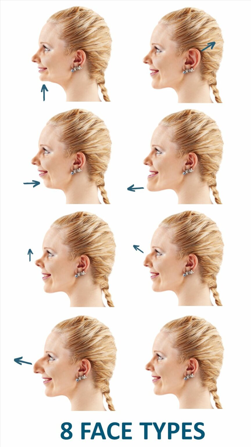 8 types de visages - Chirurgie Avant Après