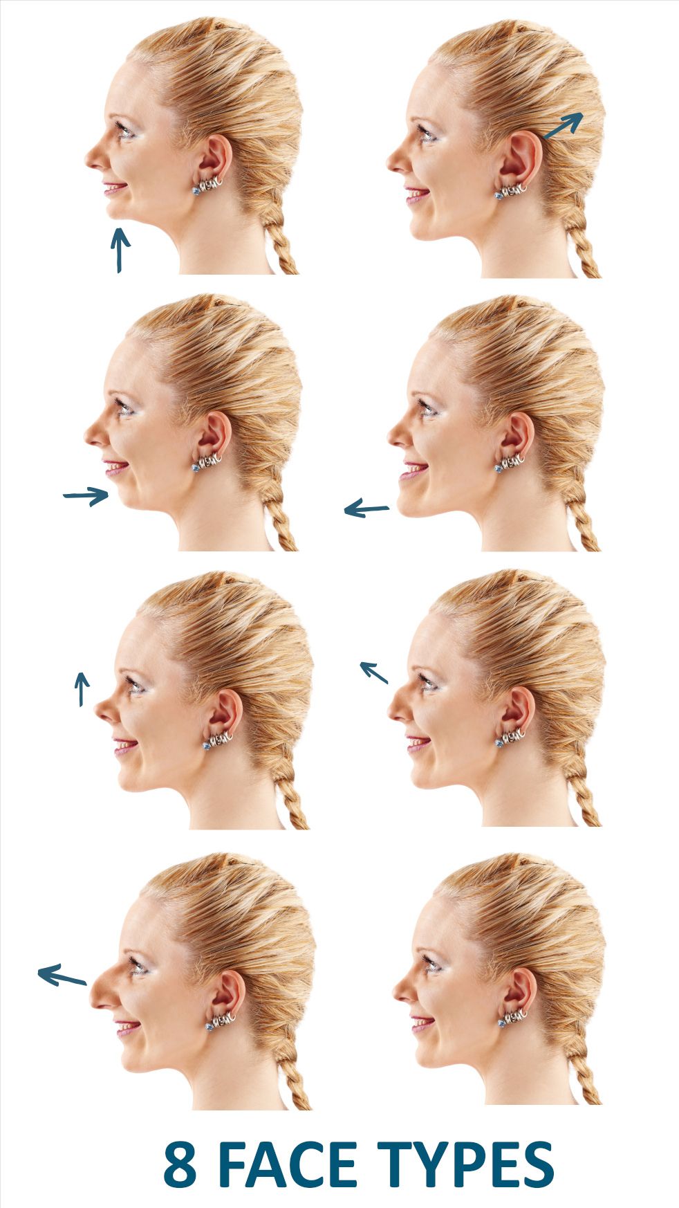 8 types de visages - Chirurgie Avant Après